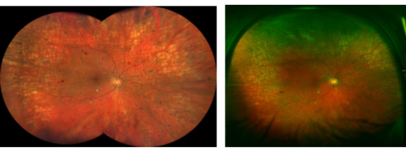 ZEISS CLARUS 500 – Systsac